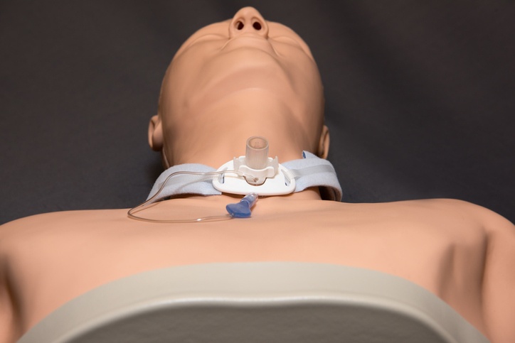 Tracheotomy Suctioning Procedure: What You Need to Know